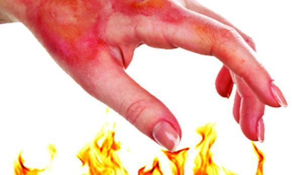 Hot Water Singes Student In Icfai Hostel