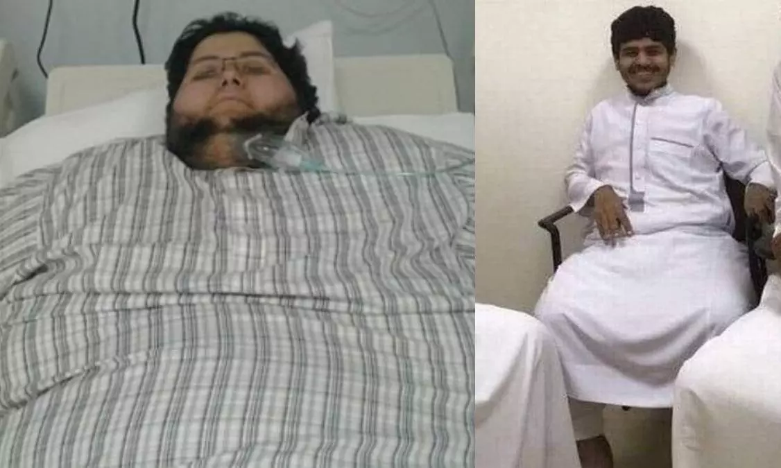 Huge Transformation World s Heaviest Man Khalid Shaari s Journey From