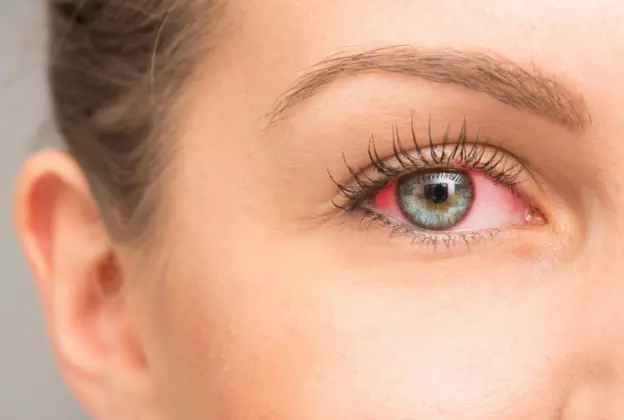 Experts Warn of Serious Eye Conditions, Urge Immediate Care