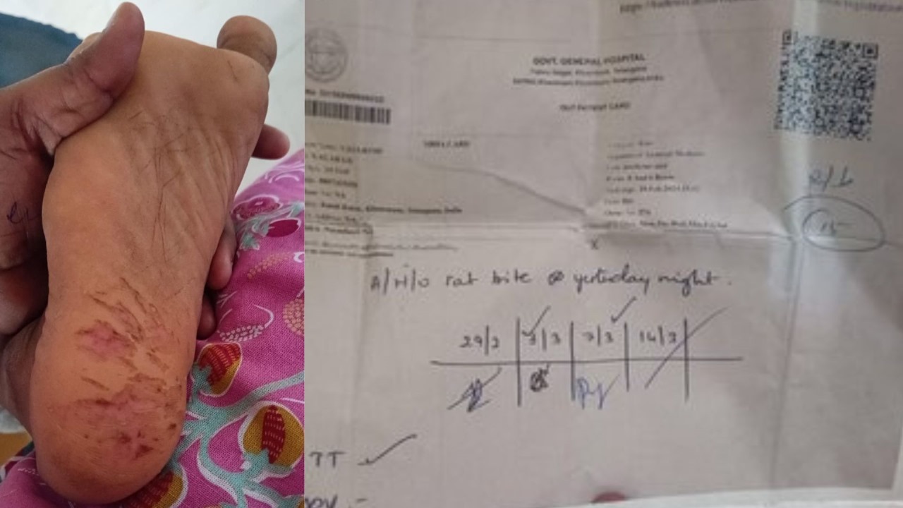 Student paralysed after rat bite still under treatment