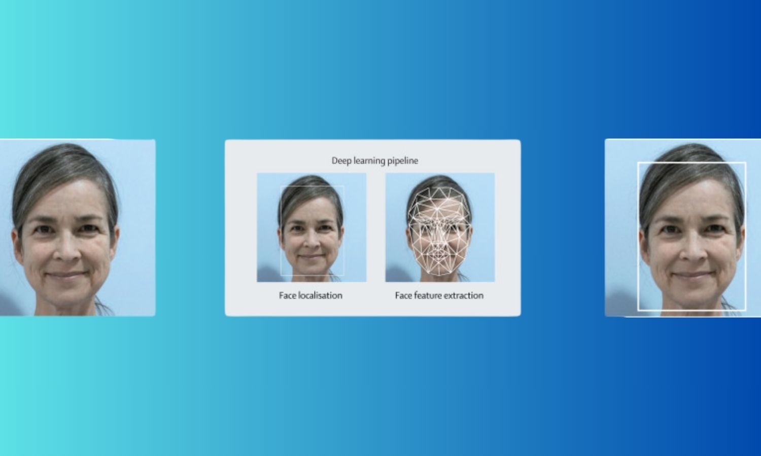 New AI Tool Can Estimate Biological Age, Cancer Survival From a Single ...