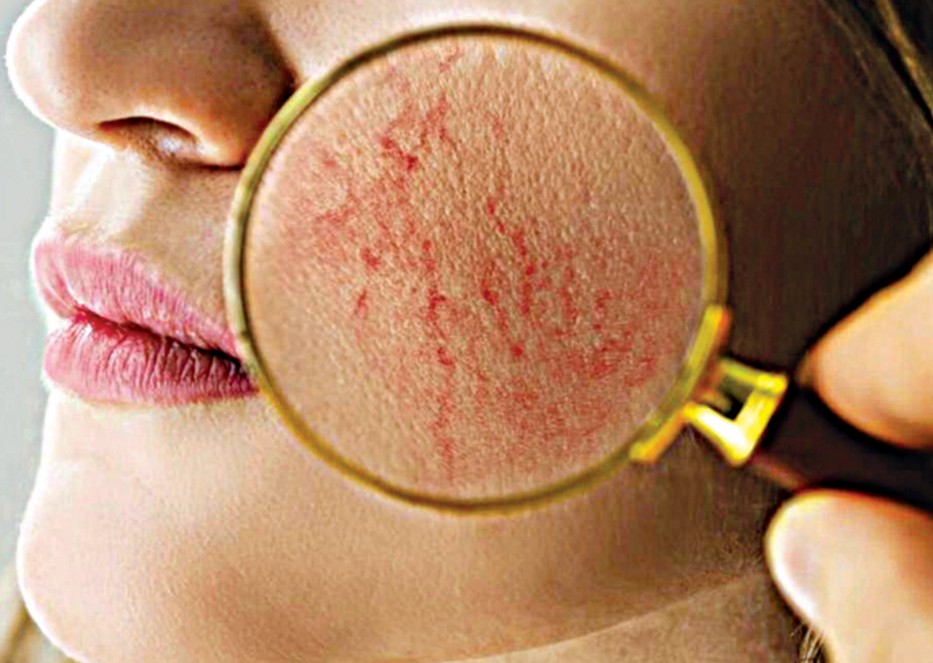 Never Overlook Your Skin’s Heartfelt Signs